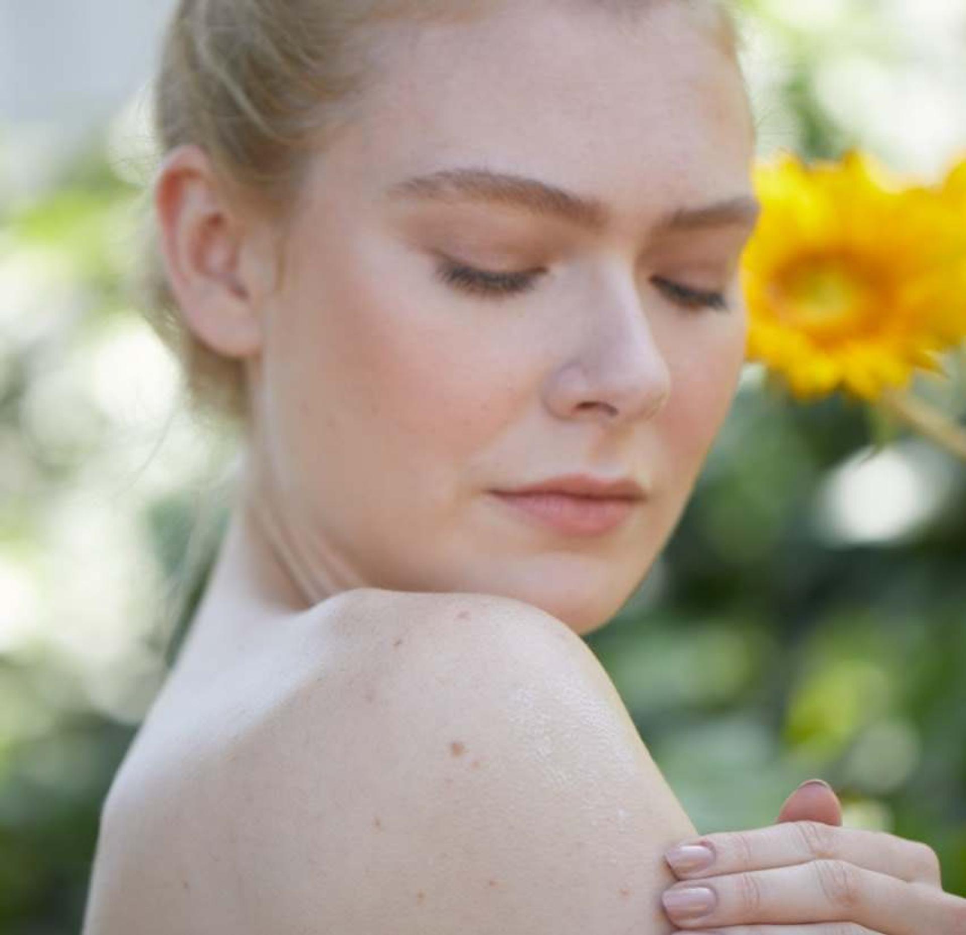 Atopia vaivaa etenkin naisia ja vanhentaa ihoa | Kauneus ja Terveys